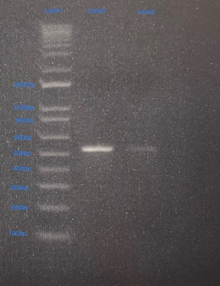 CRISPRCas9基因剪辑技术在酵母菌ADE2基因上的应用 - 爱Pia戏网,戏鲸App,Pia戏剧本